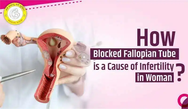 Ultimate Guide To Blocked Fallopian Tubes To Beat Infertility